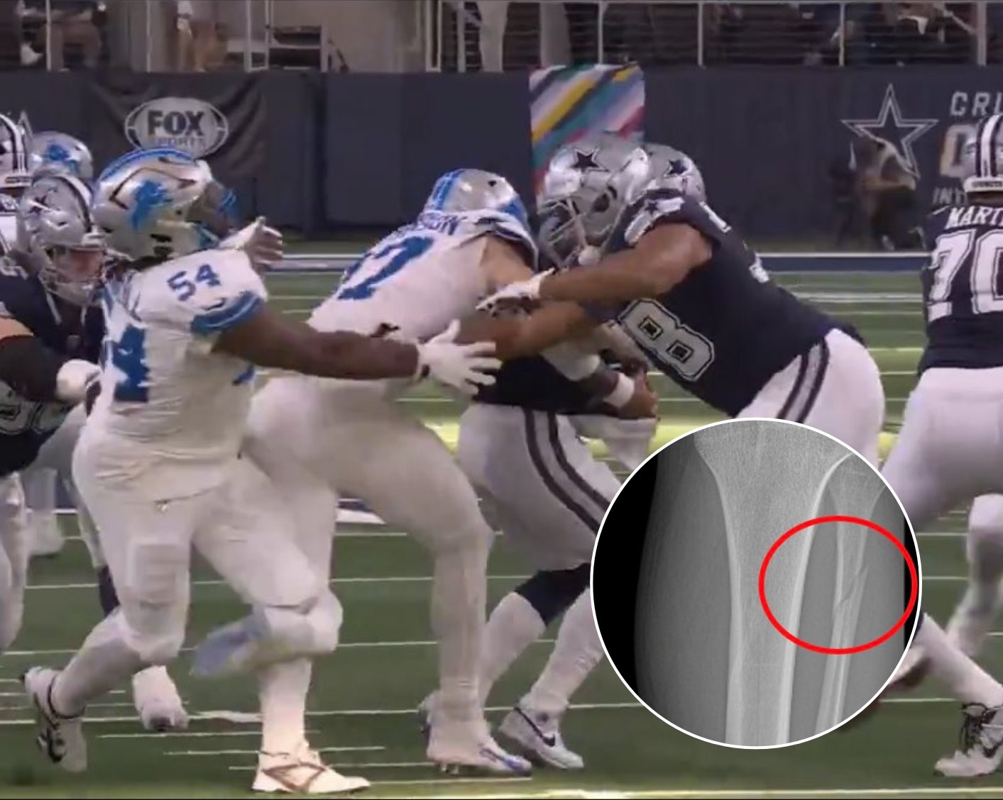 Detroit Lions have delivered an unfortunate injury update regarding star defensive player Aidan ...